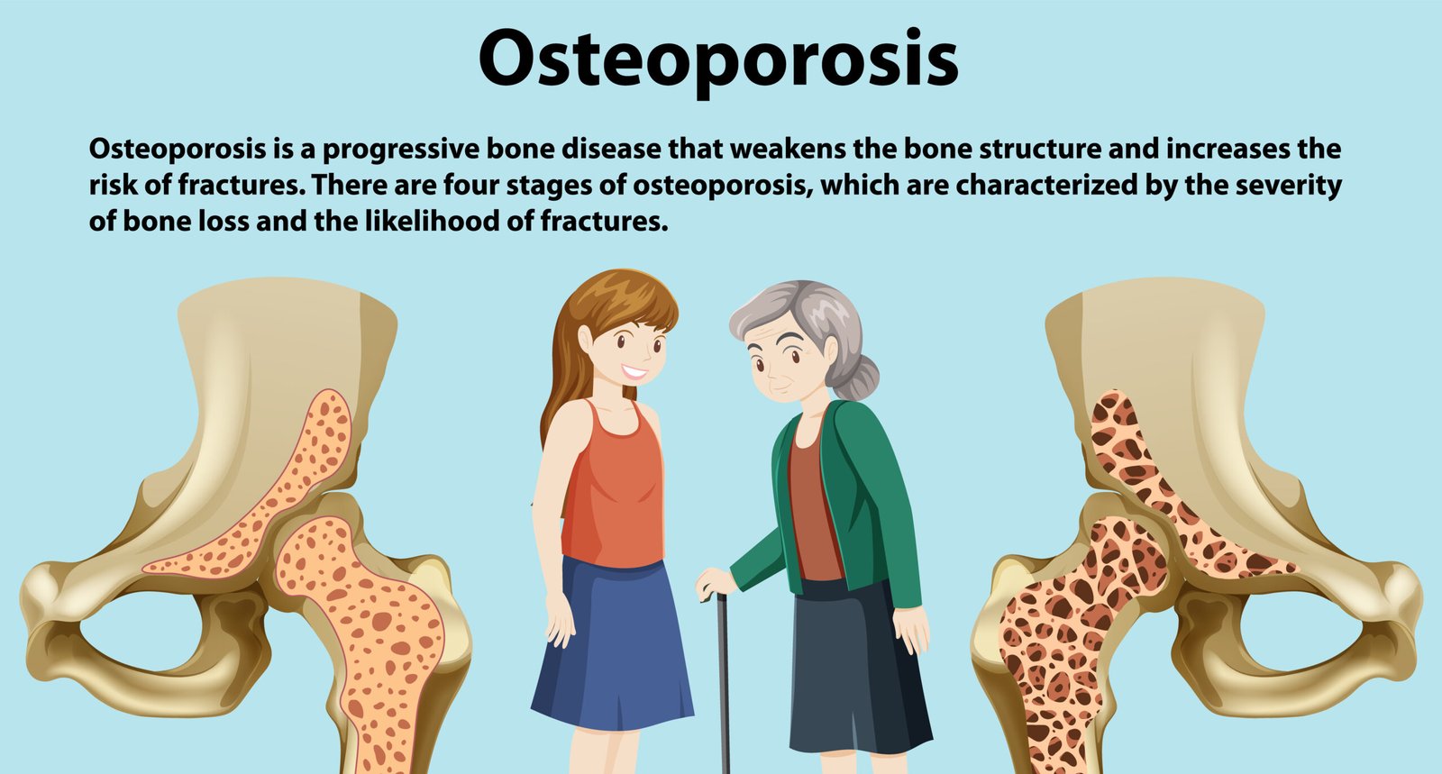 Understanding Osteopenia: Early Signs to Watch - Matrika Heritage Hospital